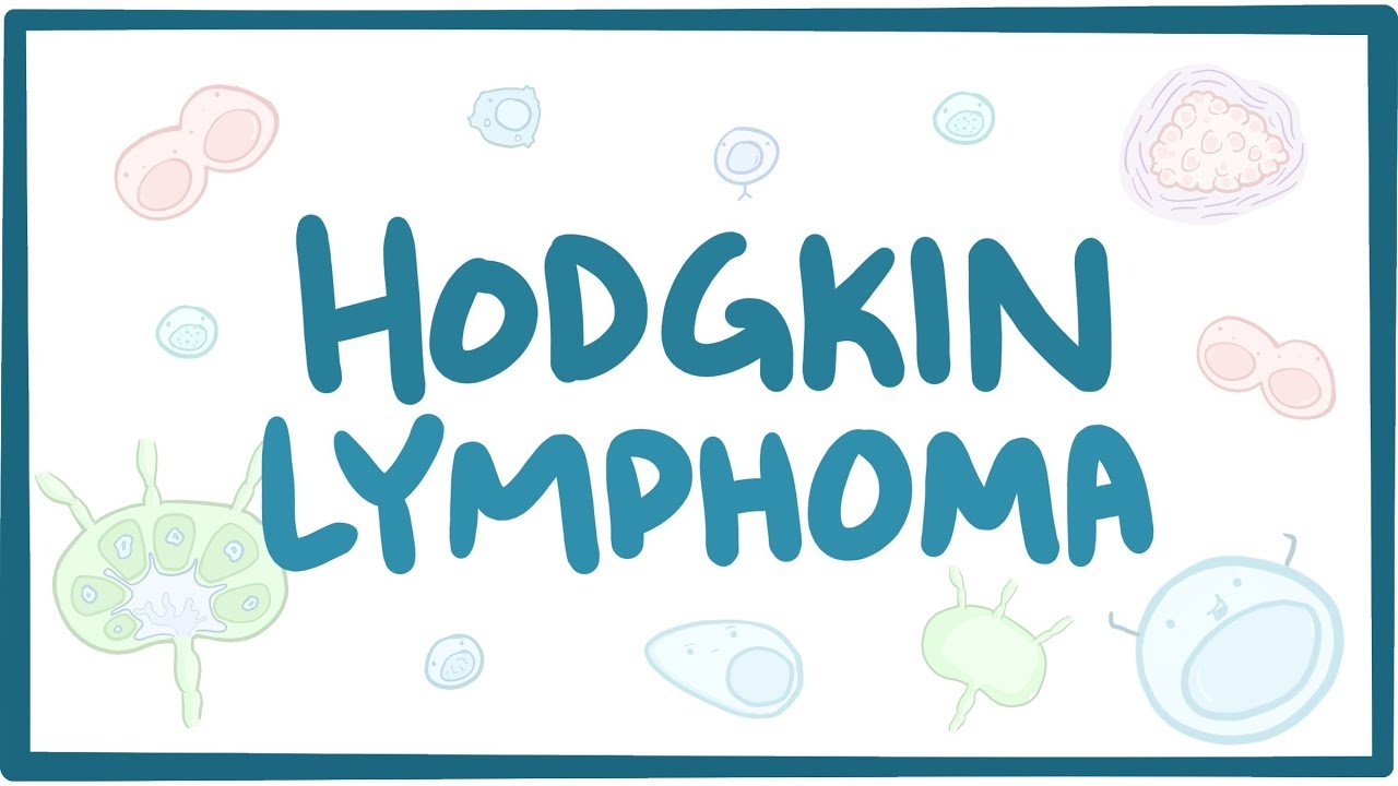 Hodgkin Lymphoma – A Sneak Peek – RRMCH